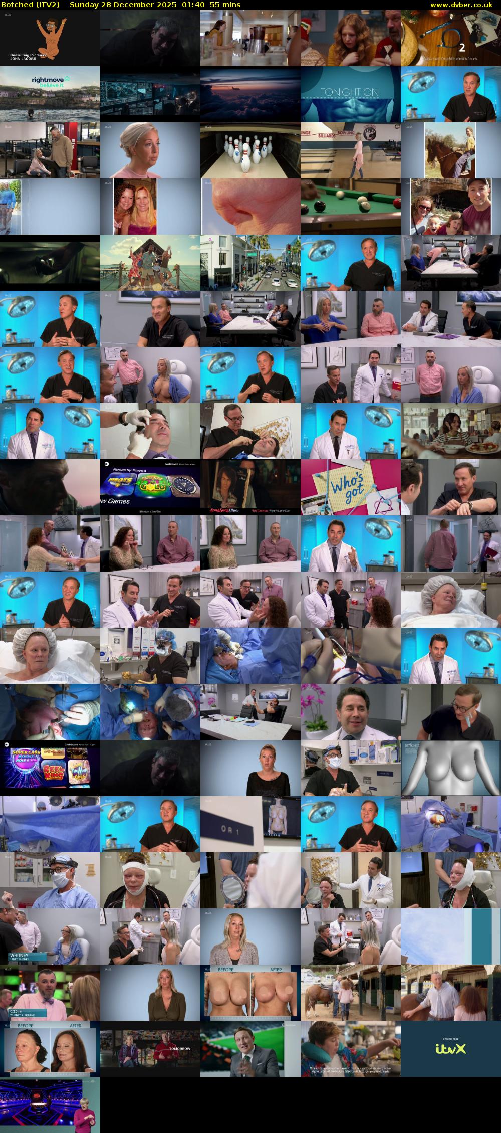 Botched (ITV2) - 2025-12-28-0140