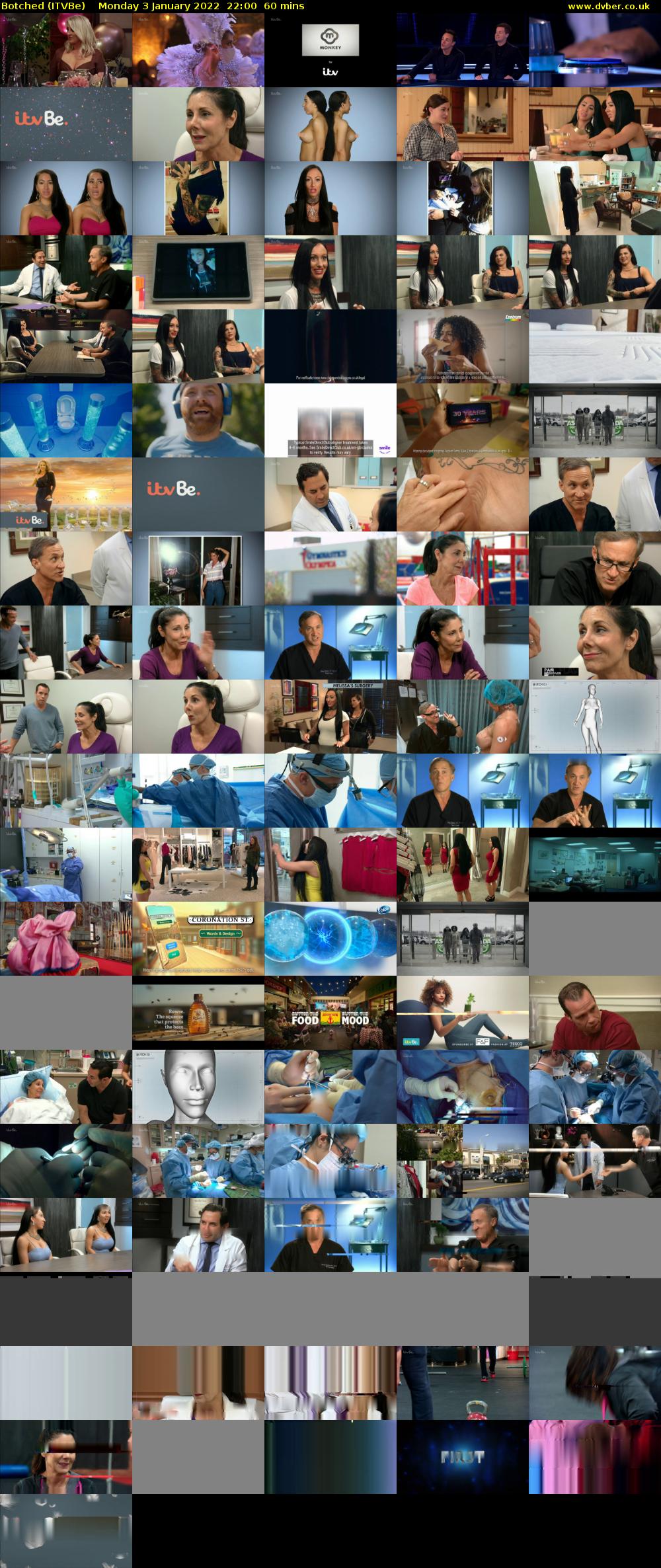 Botched (ITVBe) - 2022-01-03-2200