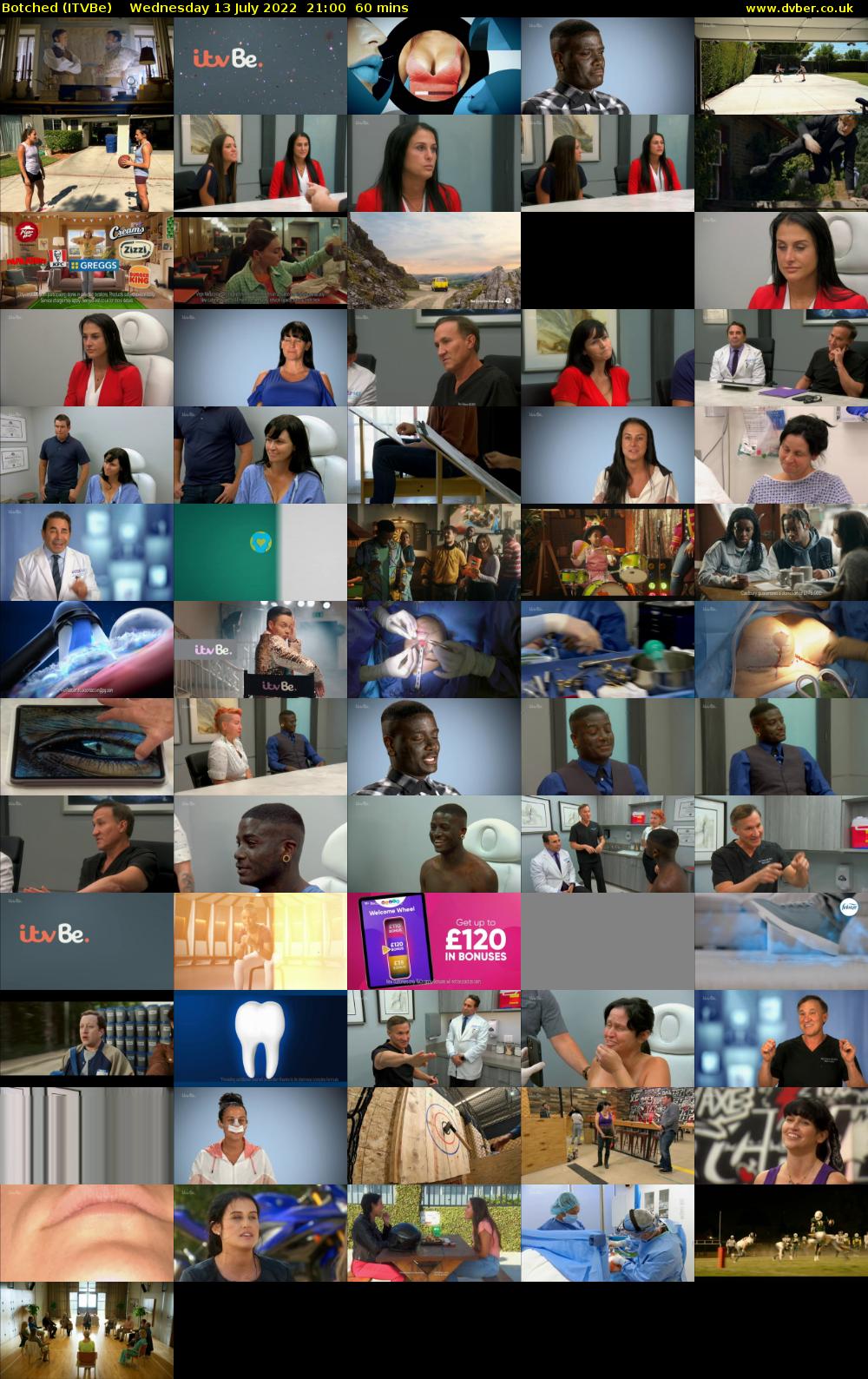 Botched (ITVBe) - 2022-07-13-2100