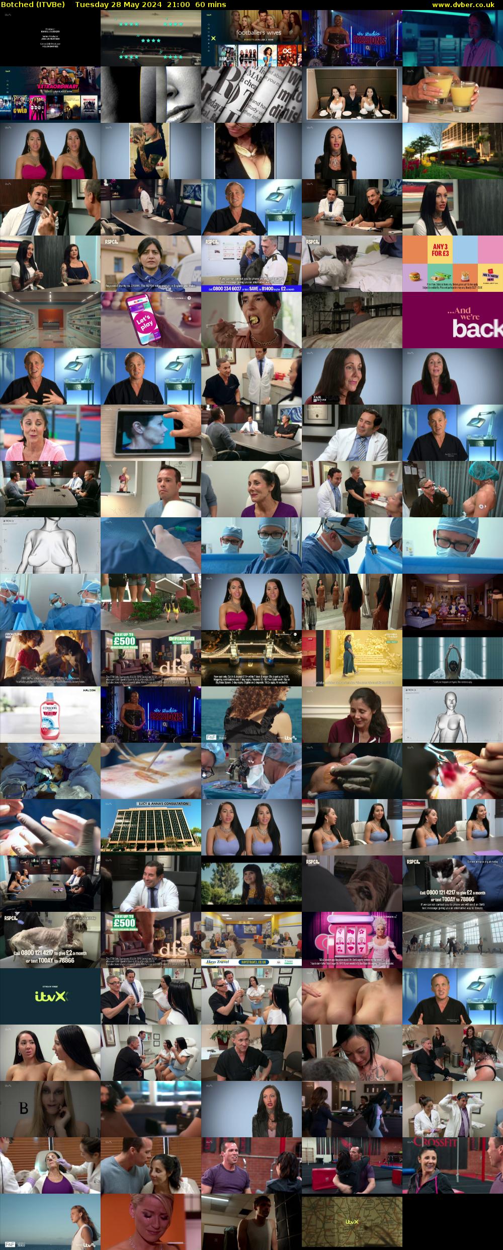 Botched (ITVBe) - 2024-05-28-2100