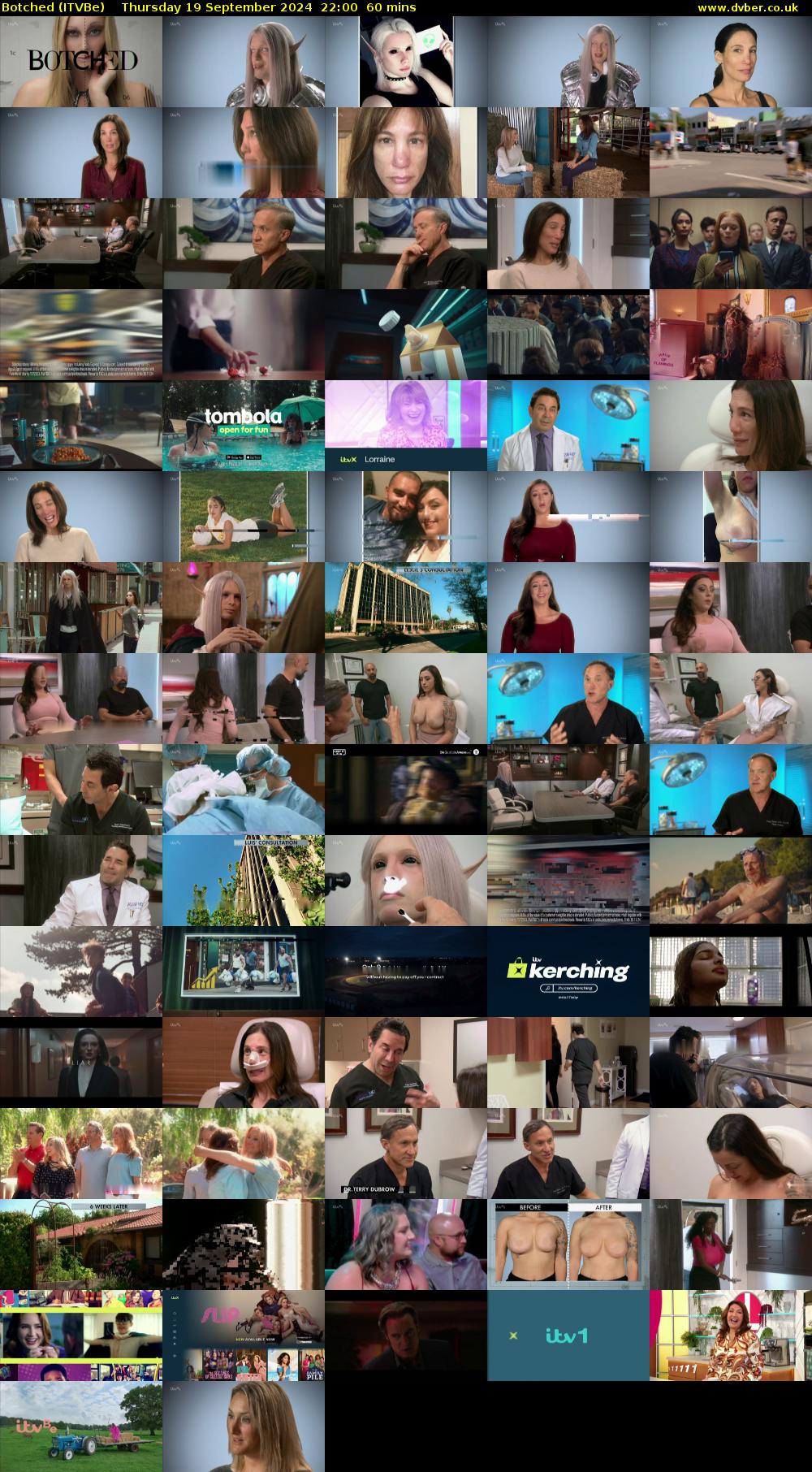 Botched (ITVBe) - 2024-09-19-2200